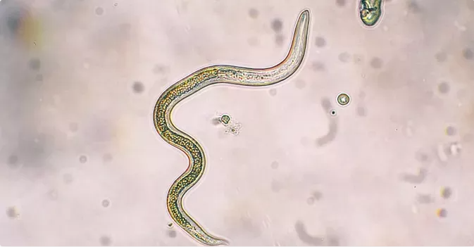 Parazit Enfeksiyonu: İçinizdeki Katil İle Tanışın | Dr. Can ile Fitekran